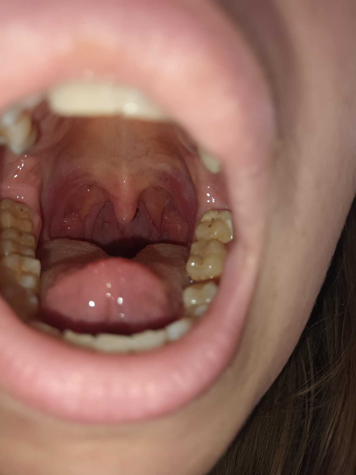 Pobolieva ma hrdlo - Modrý koník