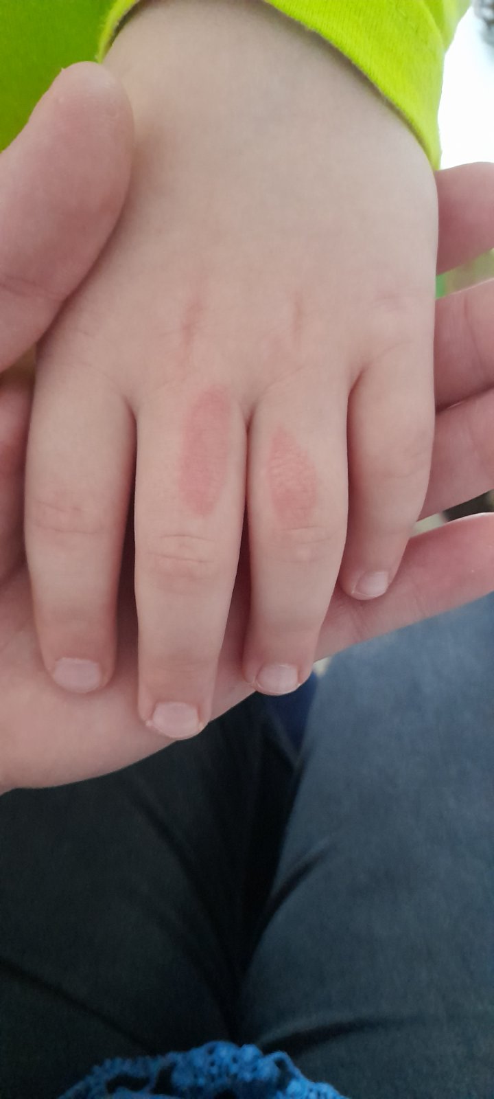 Čo to má syn na ruke? - Modrý koník