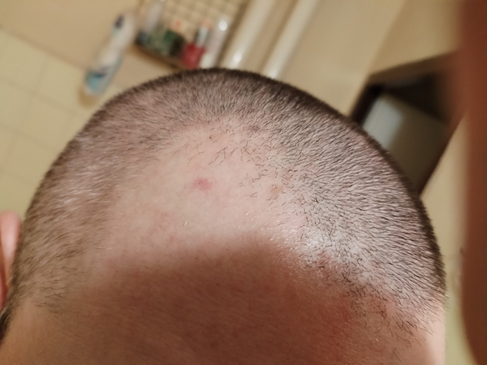 Druhýkrát ovčie kiahne - Modrý koník