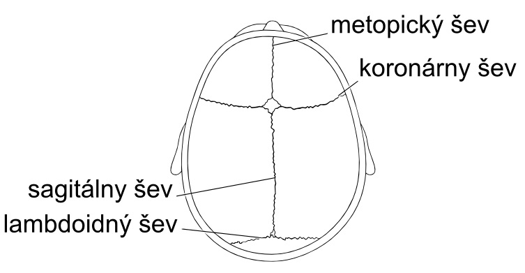 Kraniosynostóza - Modrý koník