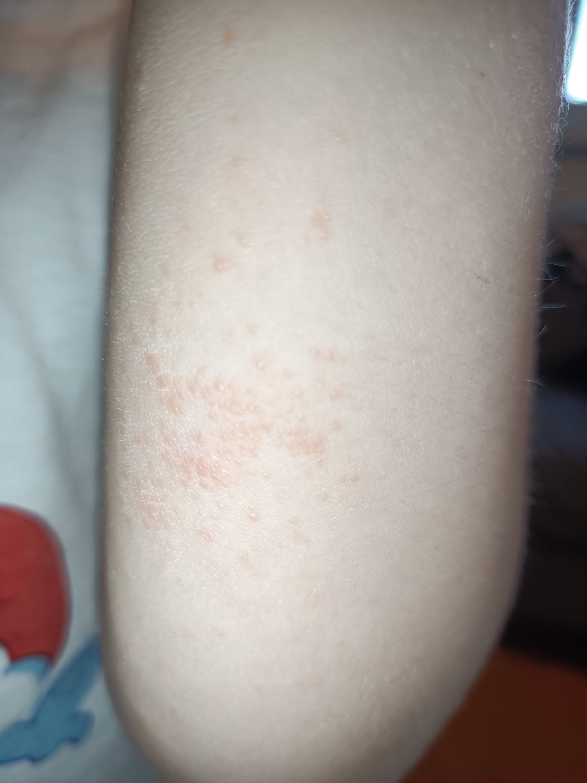 Zvláštny výsyp na ručičke - Modrý koník