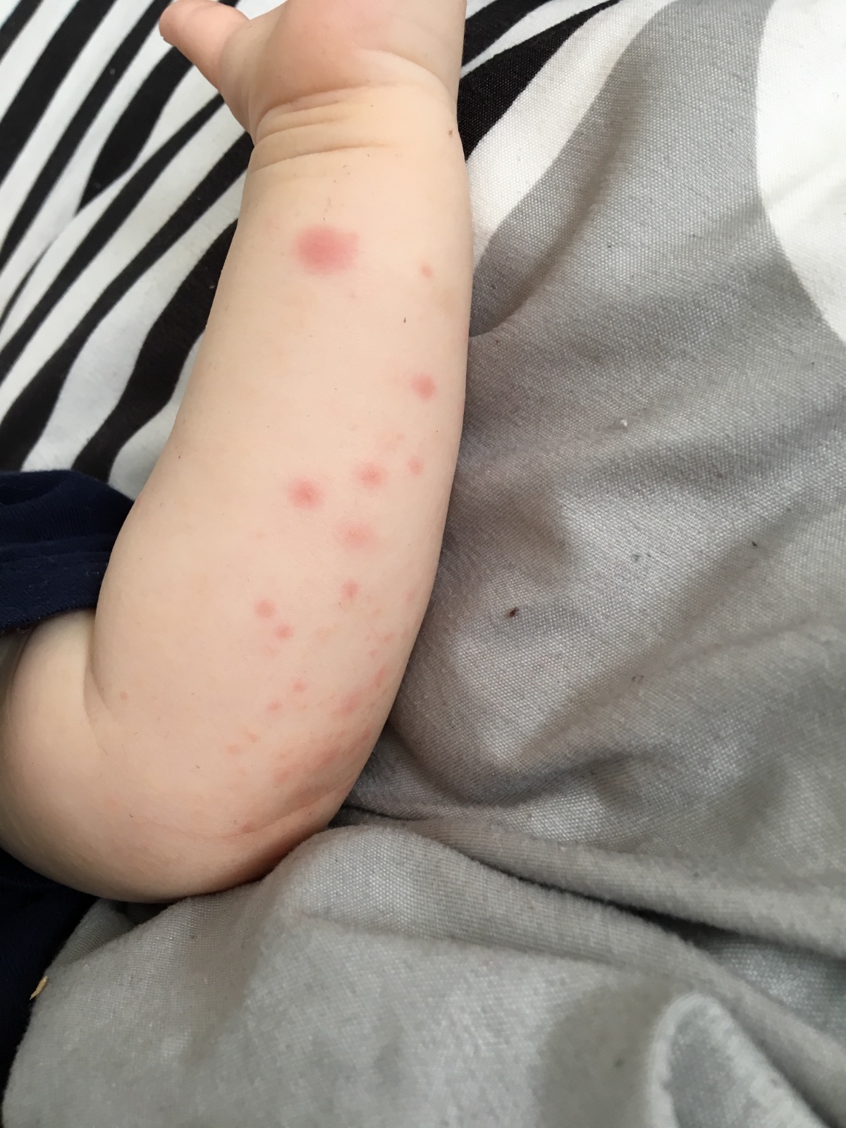 Vyrážky na ruke. Čo by to mohlo byť? - Modrý koník