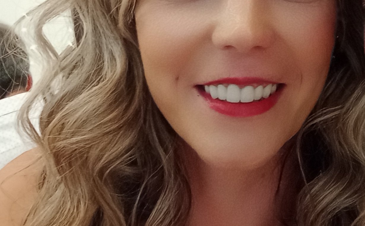 Porcelánové zuby - Modrý koník