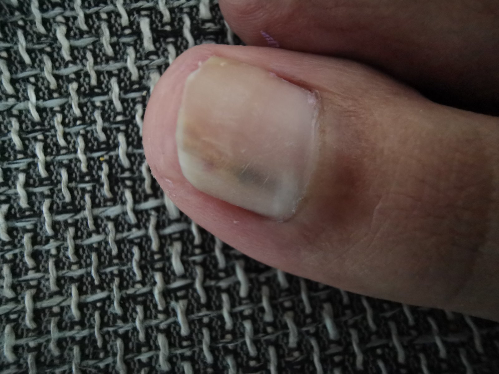 Fľaky na nechte - Modrý koník