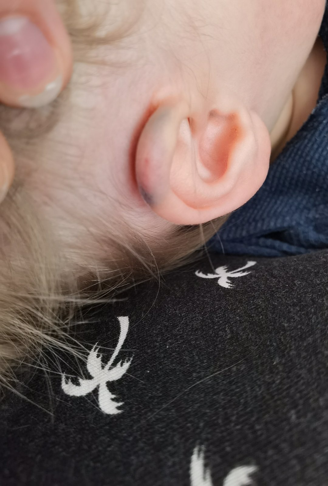 Škaredá modrina na ušku môjho syna - Modrý koník