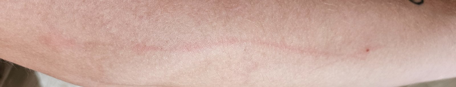 Červená čiara na ruke - Modrý koník