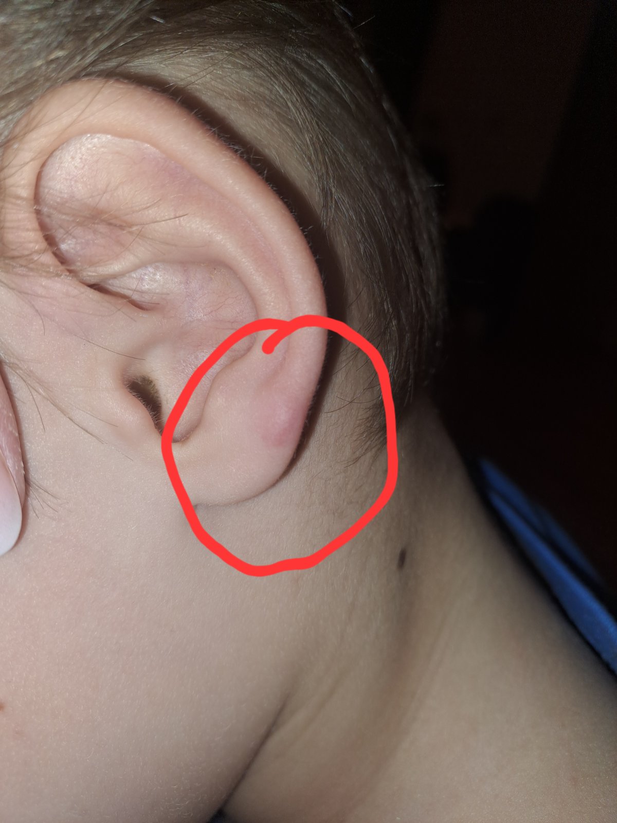 Čo to má syn na uchu? - Modrý koník