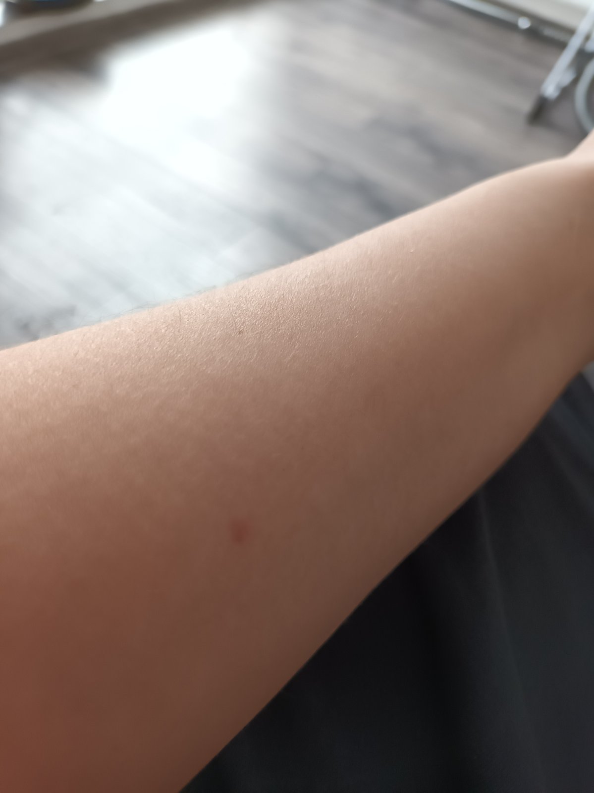 Čo to mám na ruke? - Modrý koník