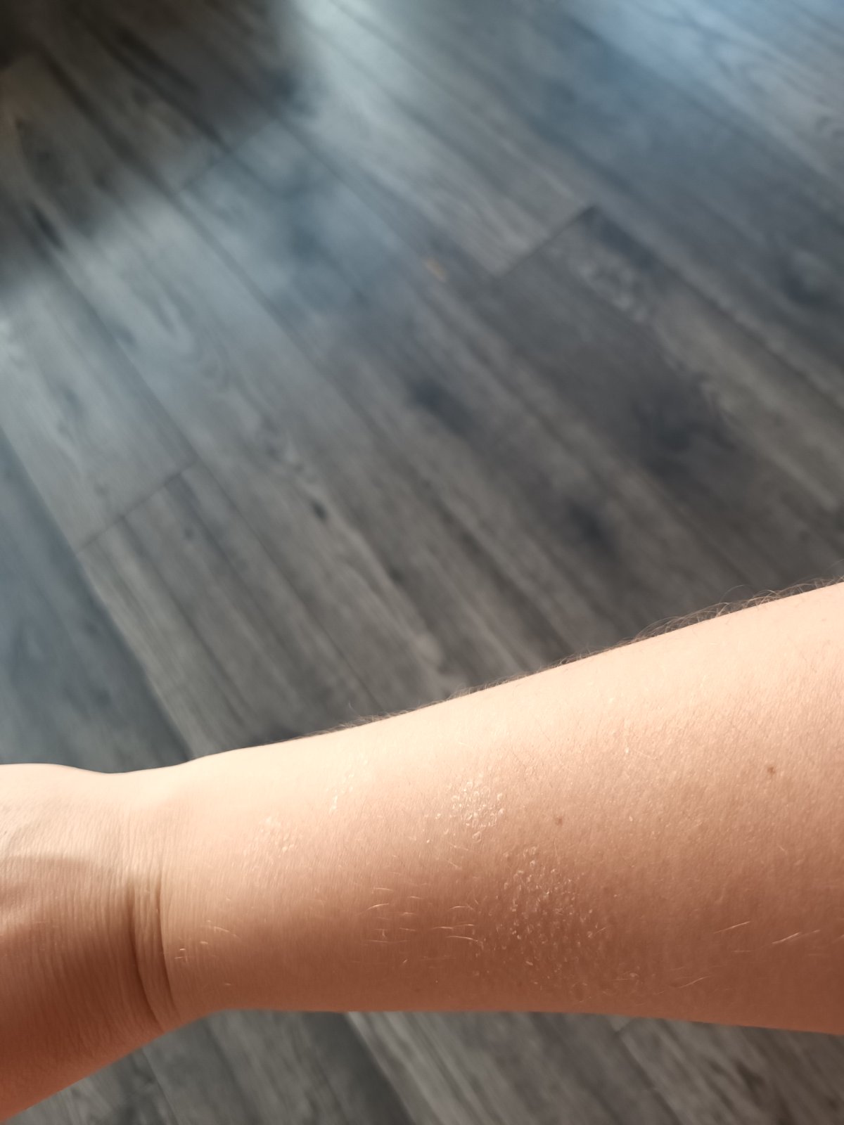 Čo to mám na ruke? - Modrý koník