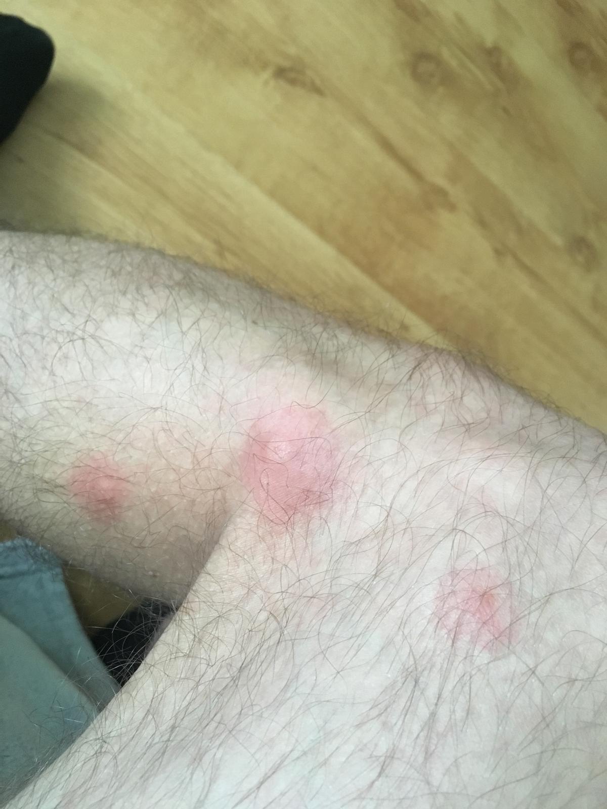 Môže to byť blcha? - Modrý koník