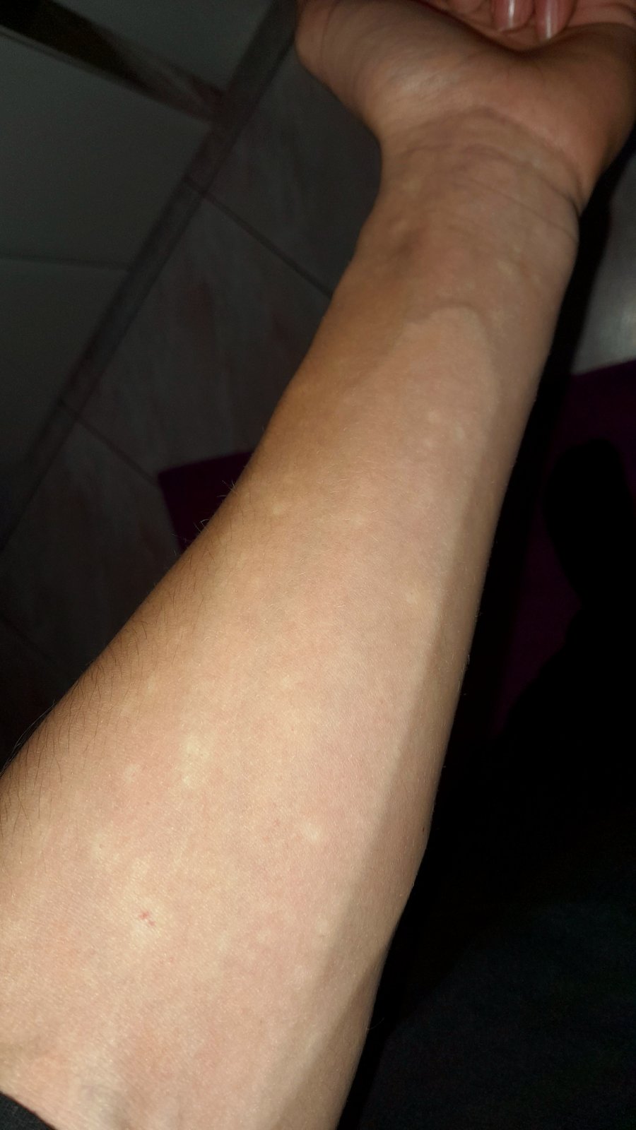 Čo sú tieto bodky na ruke? - Modrý koník