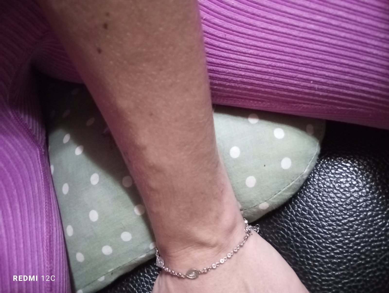 Čo je toto na ruke? - Modrý koník