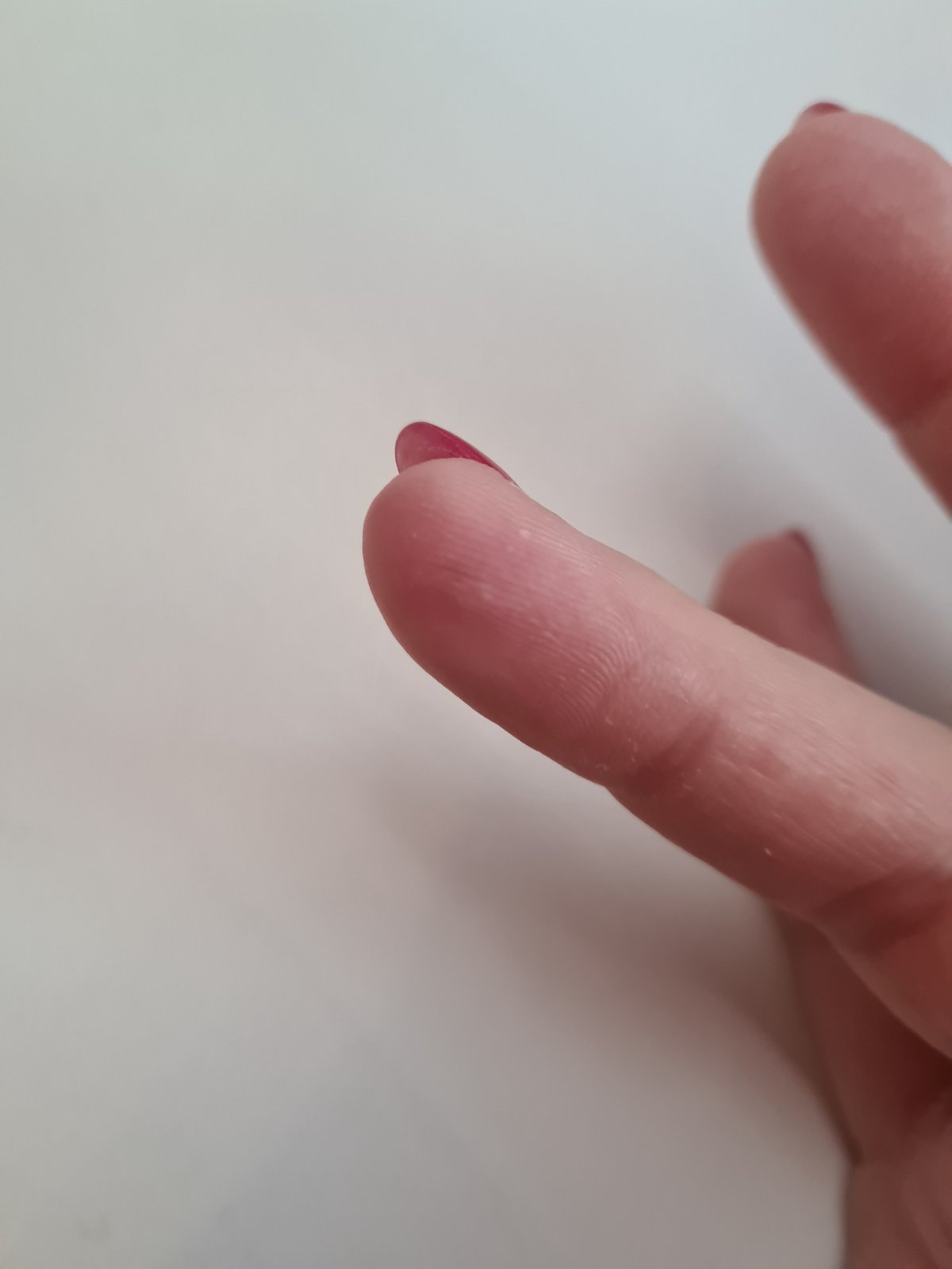 Čo za vyrážky to mám na rukách? - Modrý koník