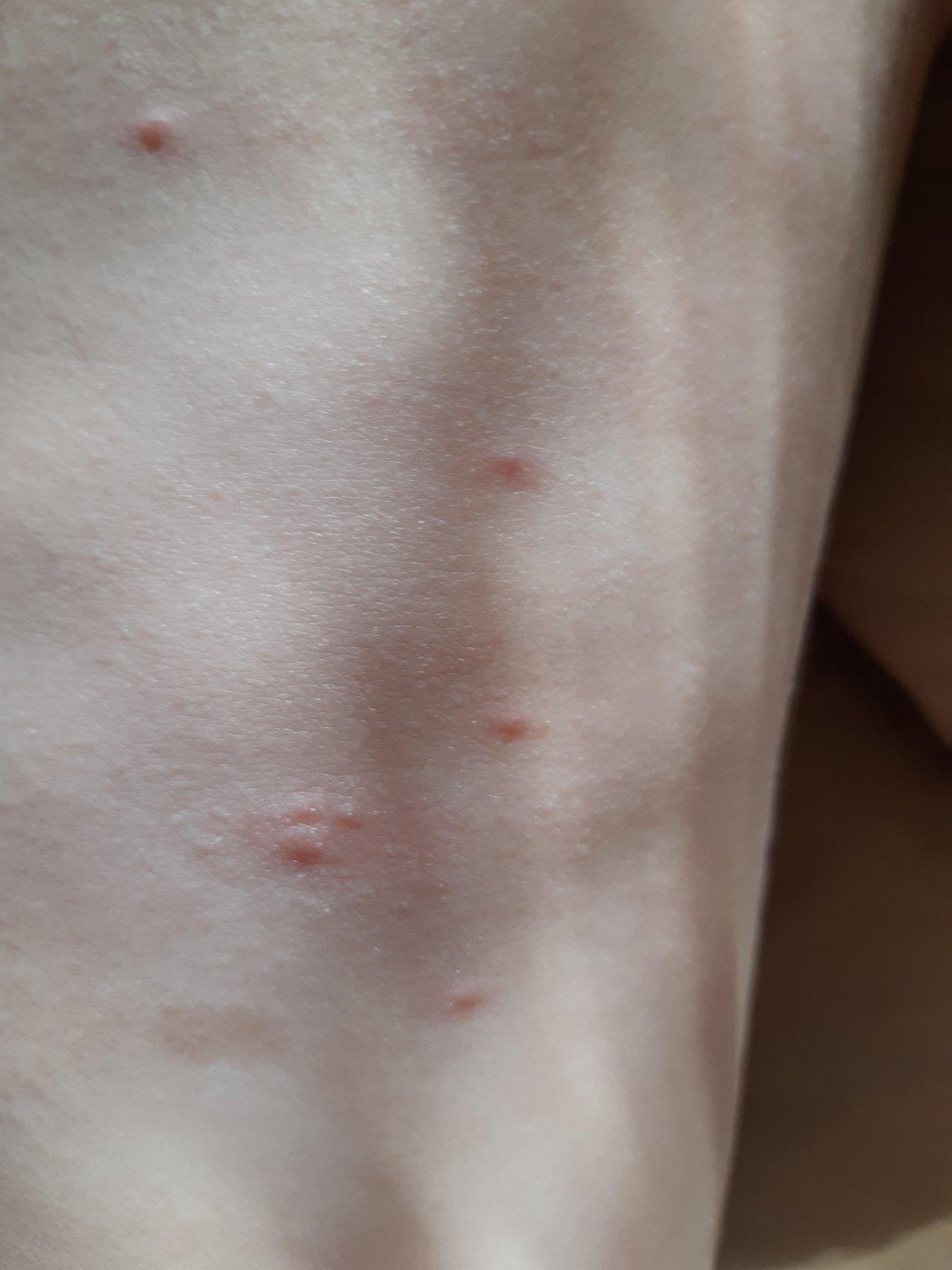 Sú toto kiahne? - Modrý koník