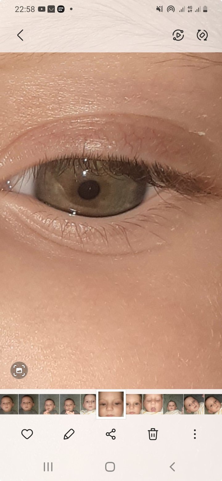 Do akého veku sa mení farba očí? - Modrý koník