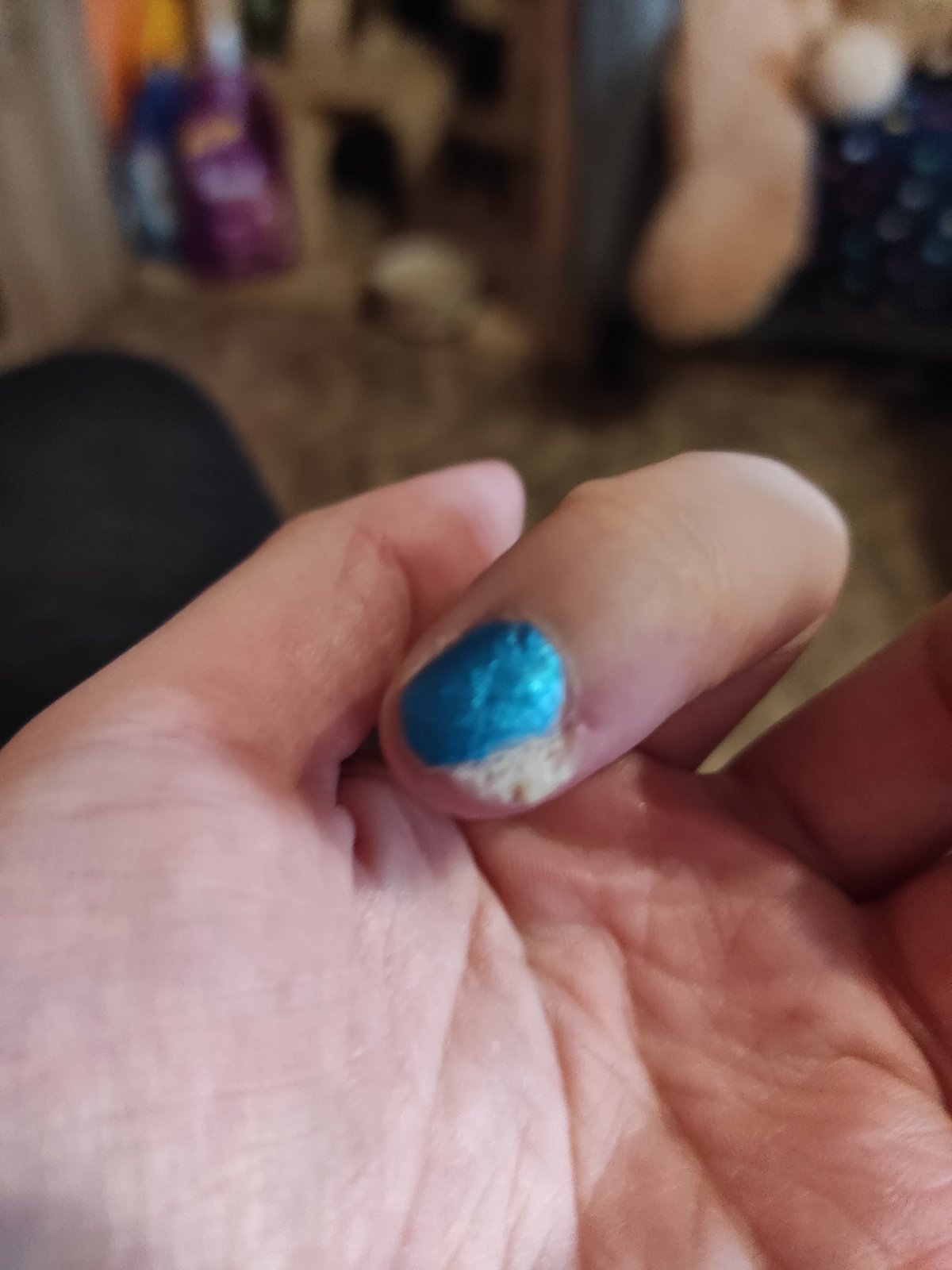 Bradavica na ruke - Modrý koník