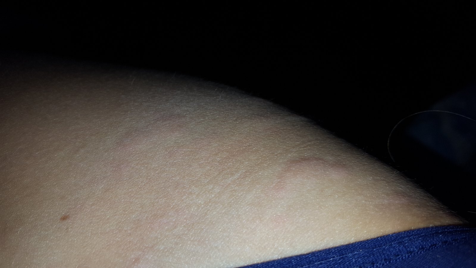 Miznúce svrbivé štípance? - Modrý koník