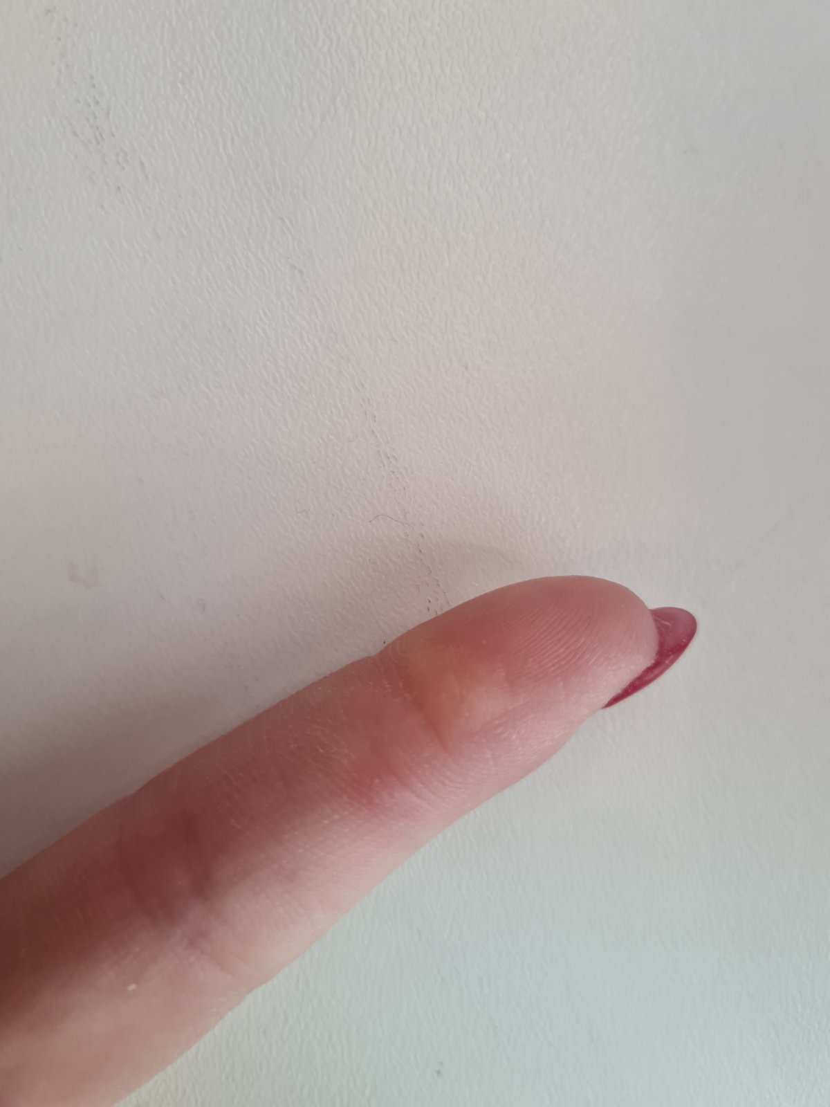 Čo za vyrážky to mám na rukách? - Modrý koník