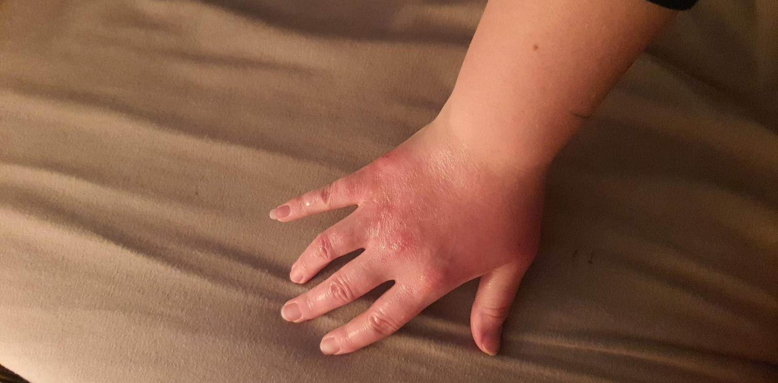 Niečo na popraskané ruky - Modrý koník