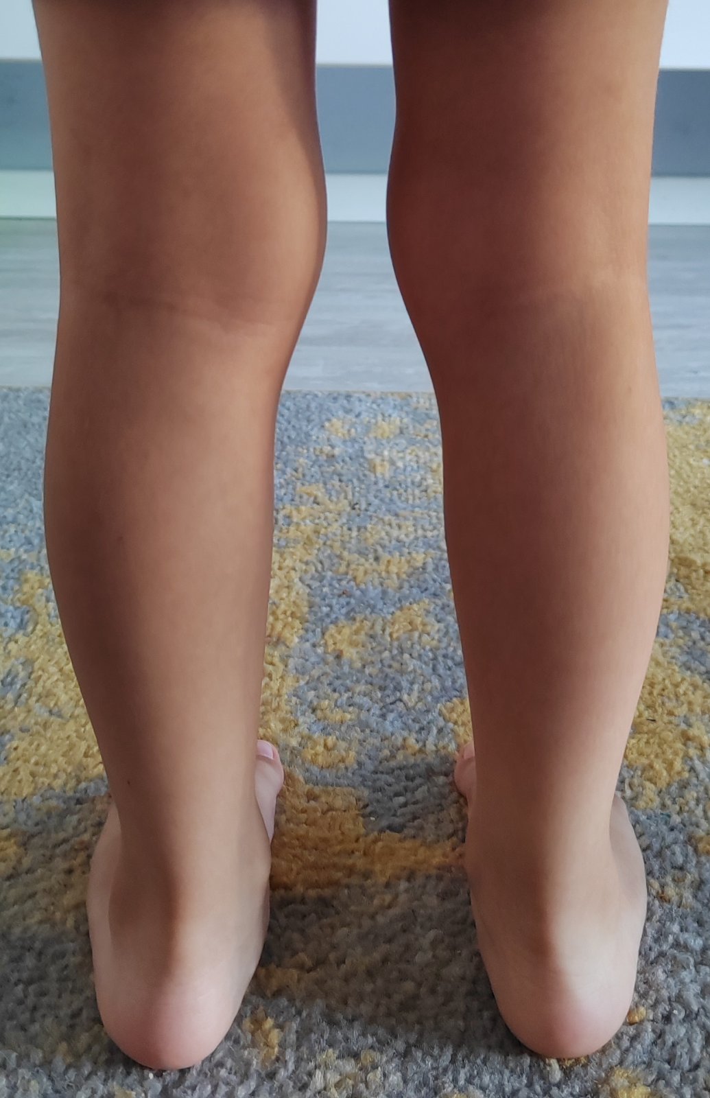 Sú to nohy do X? - Modrý koník