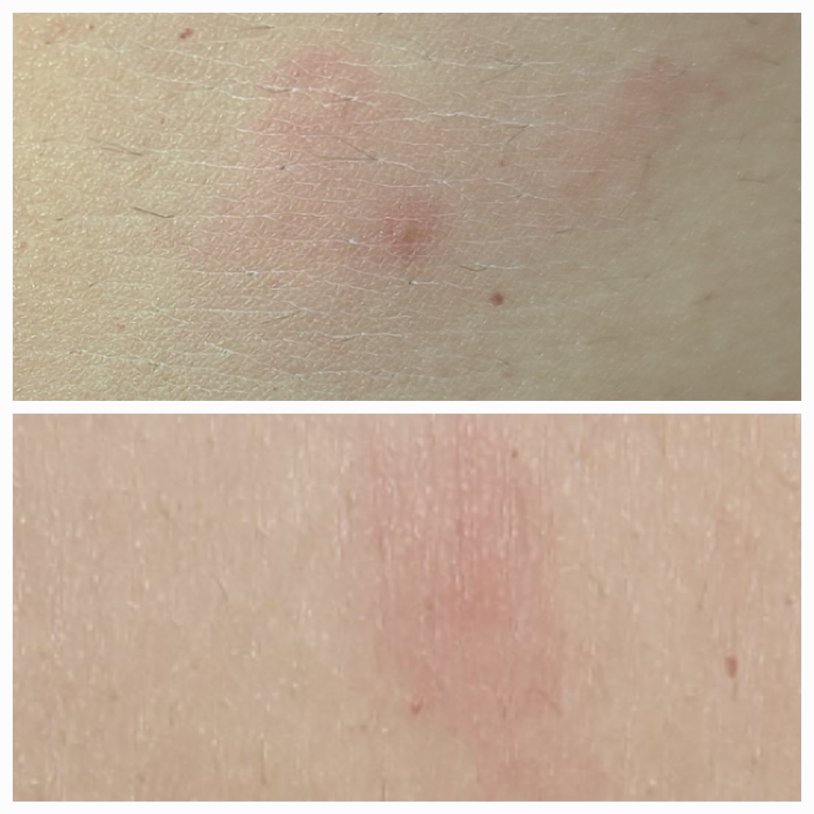 Kiahne v dospelosti - Modrý koník