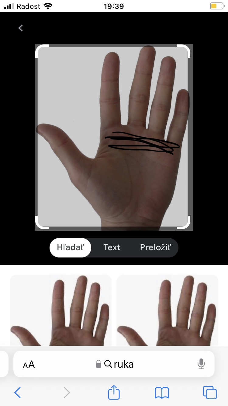 Kostičky na ruke - zvláštna bolesť - Modrý koník