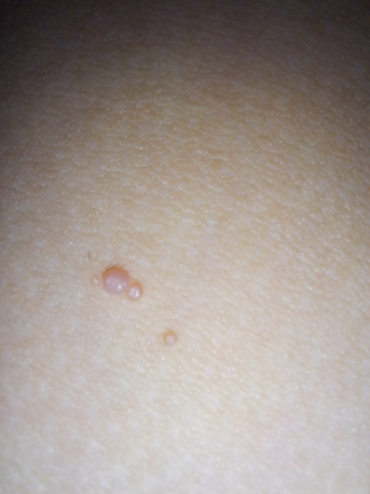 Čo to má môj syn na nožičke? - Modrý koník