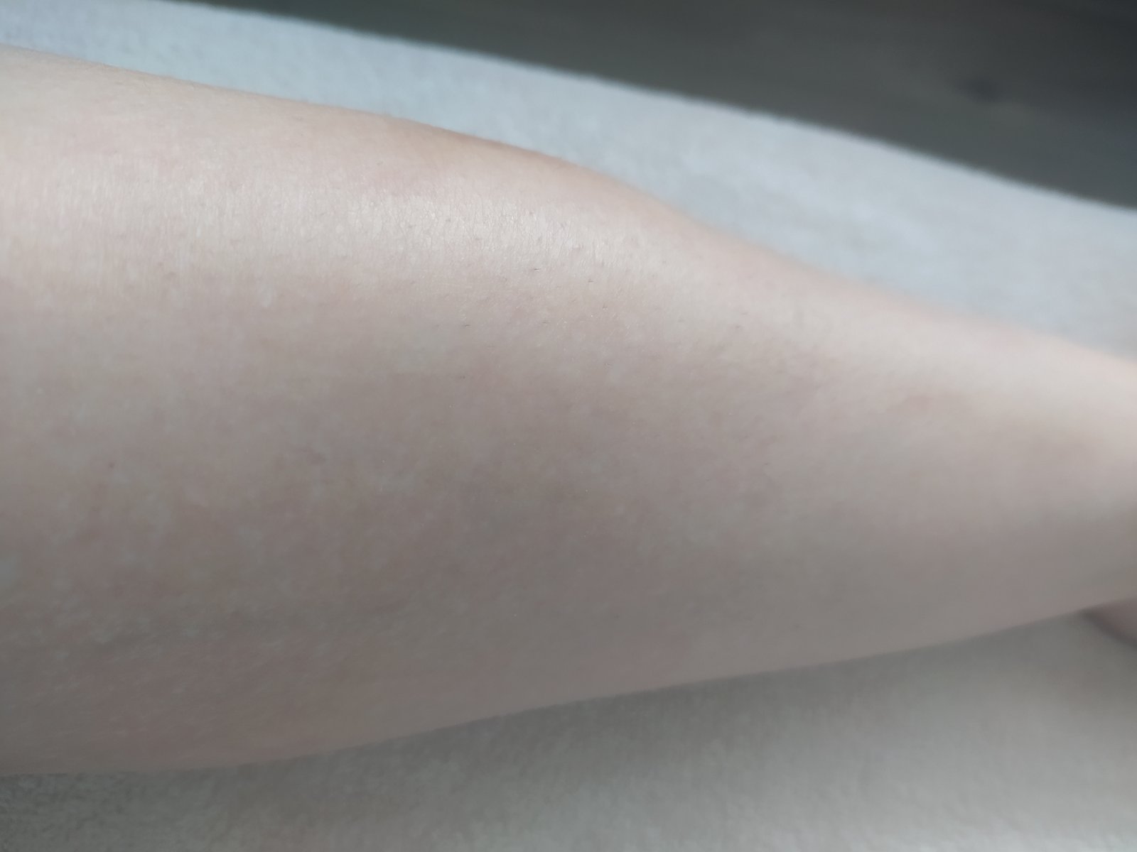 Opuch na nohe - Modrý koník