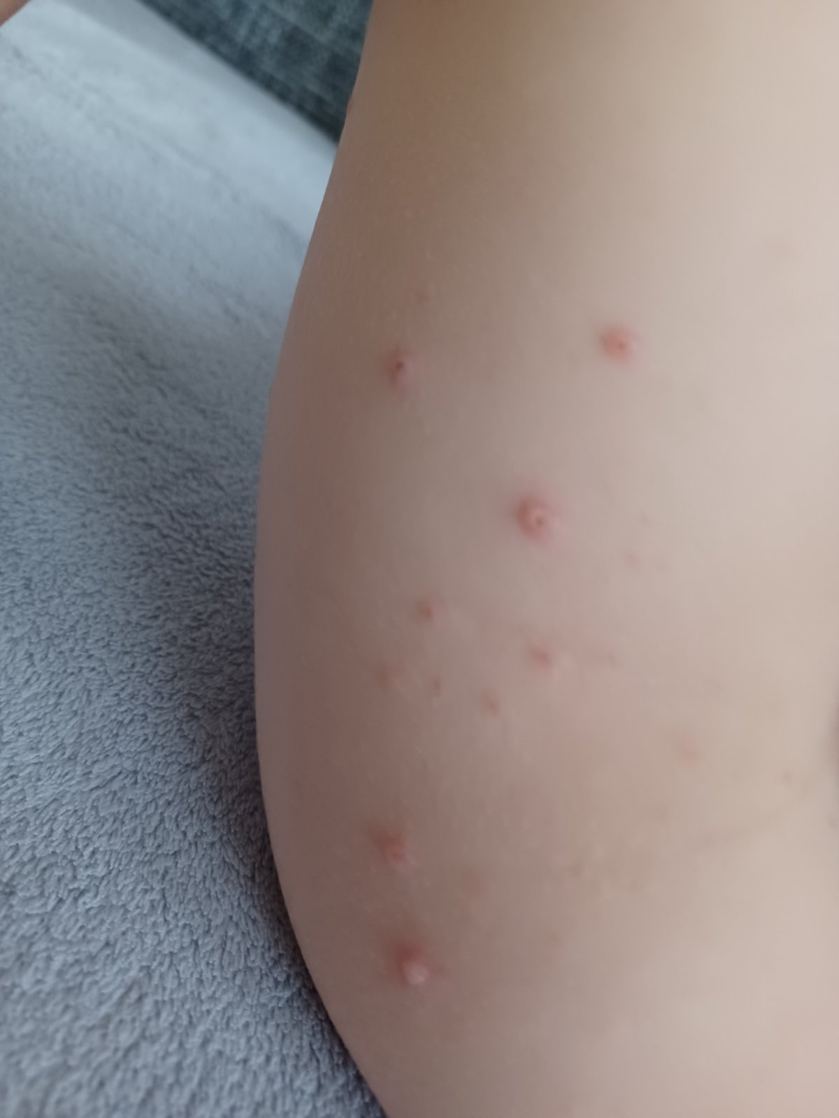 Sú toto ovčie kiahne? - Modrý koník