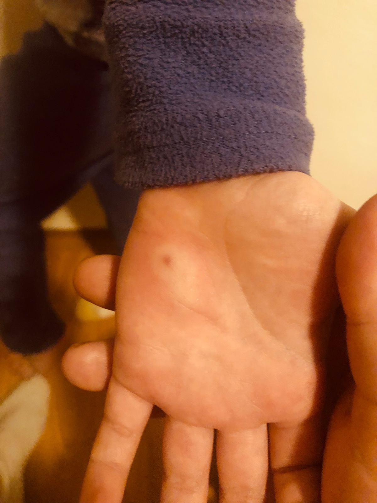 Čo to má dcérka na ruke? - Modrý koník