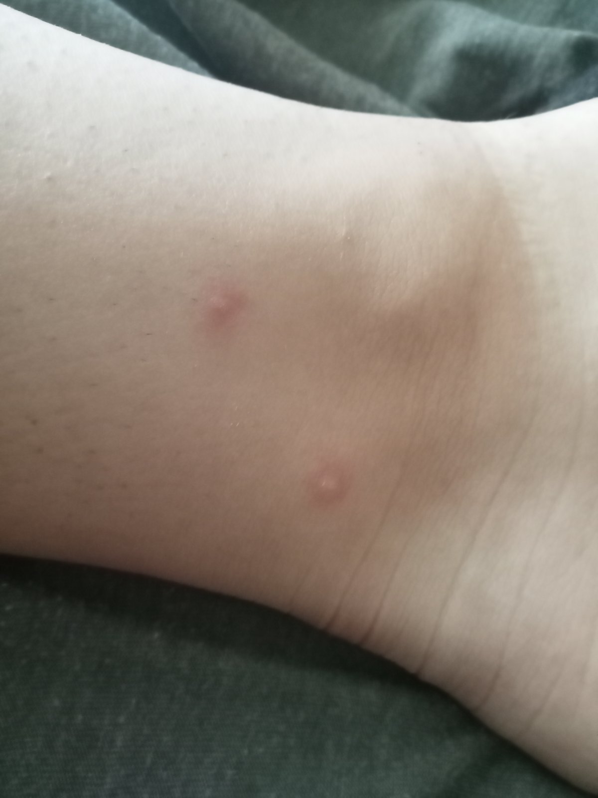 Mám divné štípance - Modrý koník