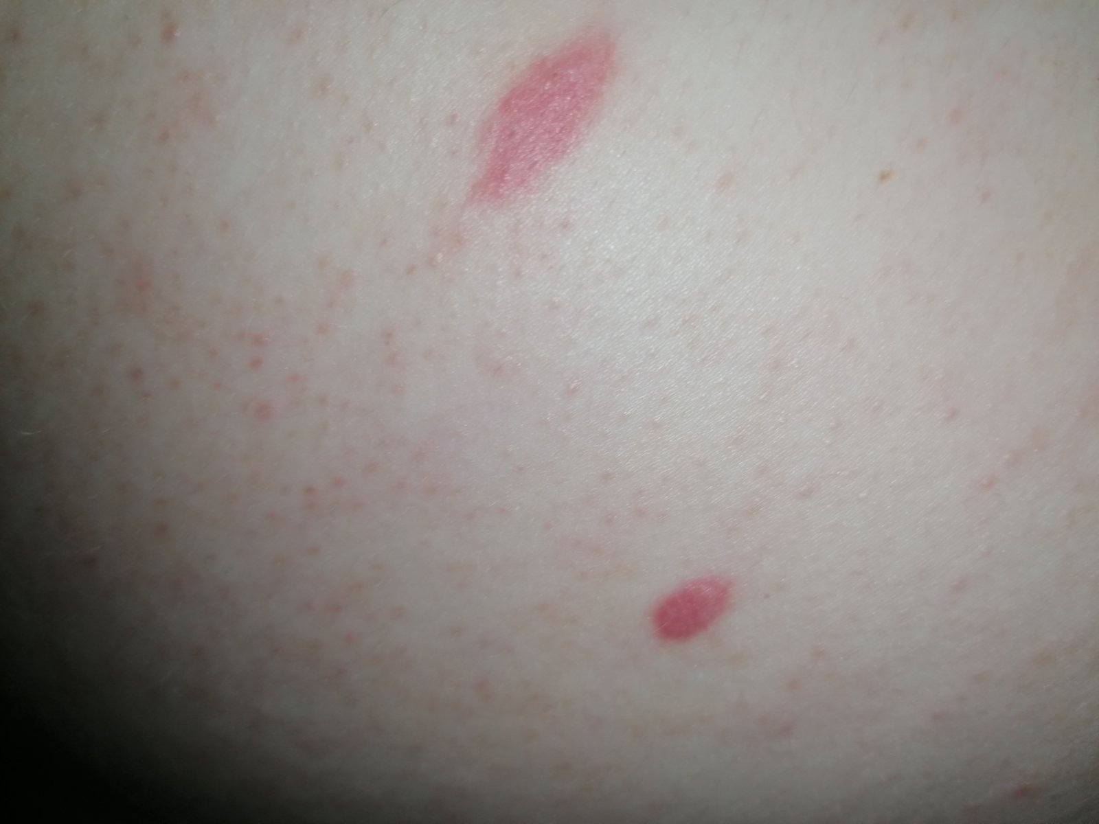 Sú to ploštice? - Modrý koník