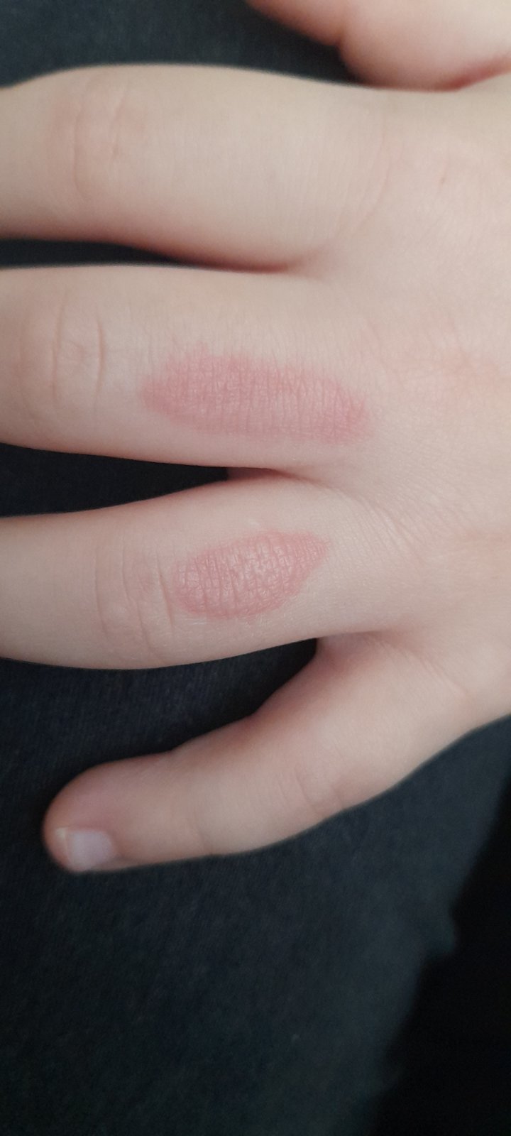 Čo to má syn na ruke? - Modrý koník