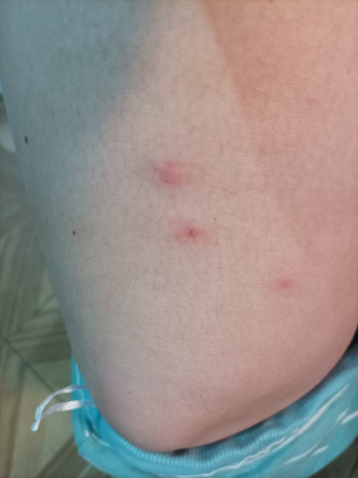 Od čoho sú tieto štípance? - Modrý koník