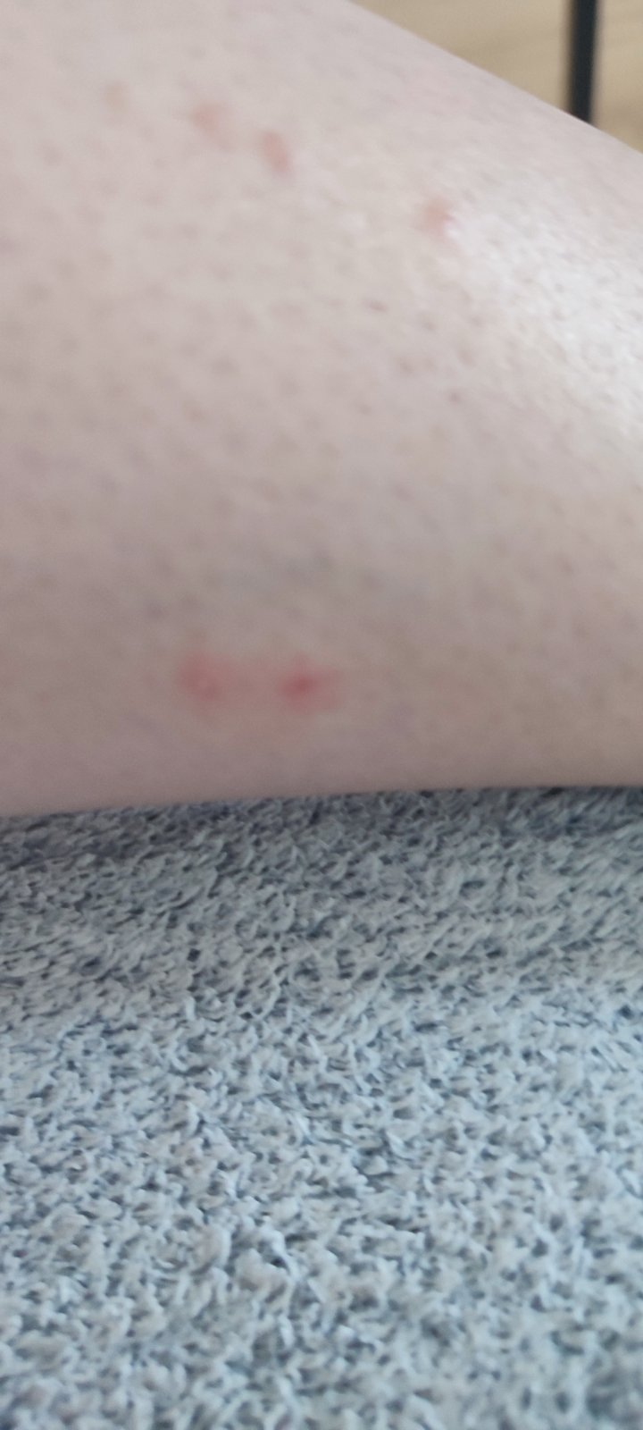 Sú toto štípance od ploštice? - Modrý koník