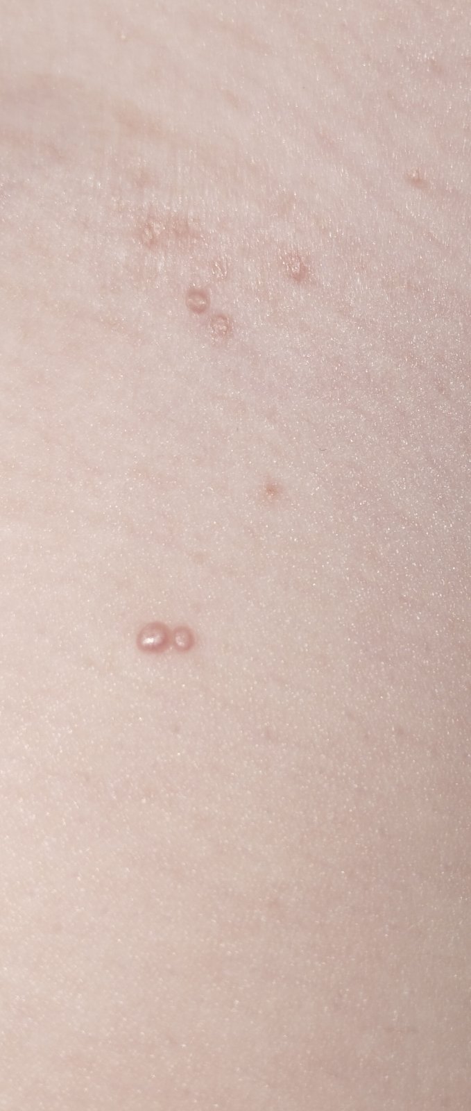 Ide o molusky? - Modrý koník