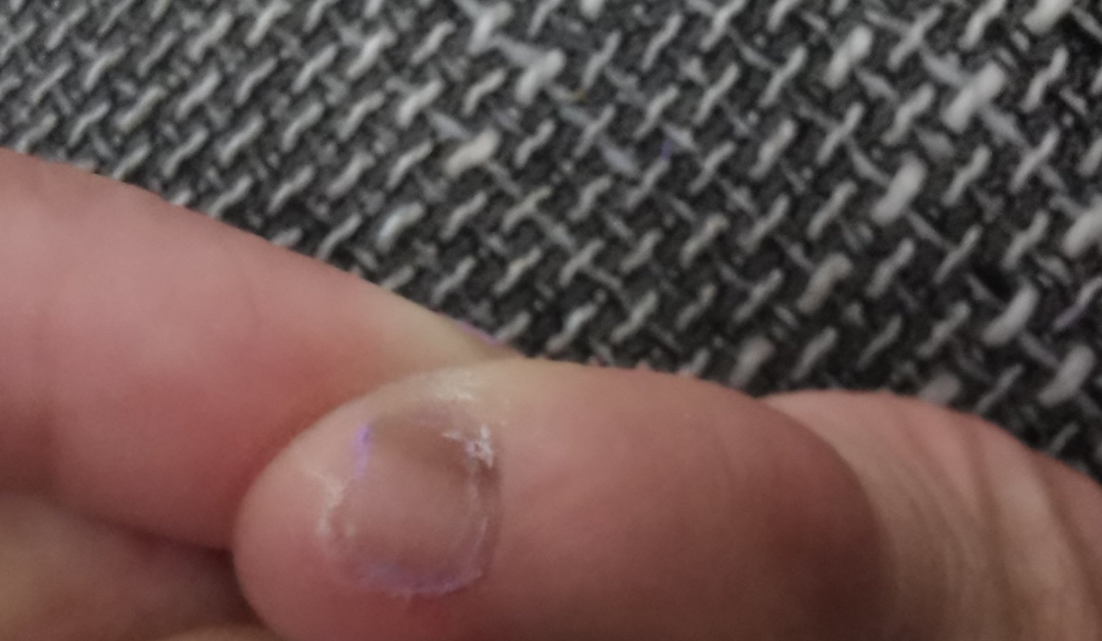 Fľaky na nechte - Modrý koník