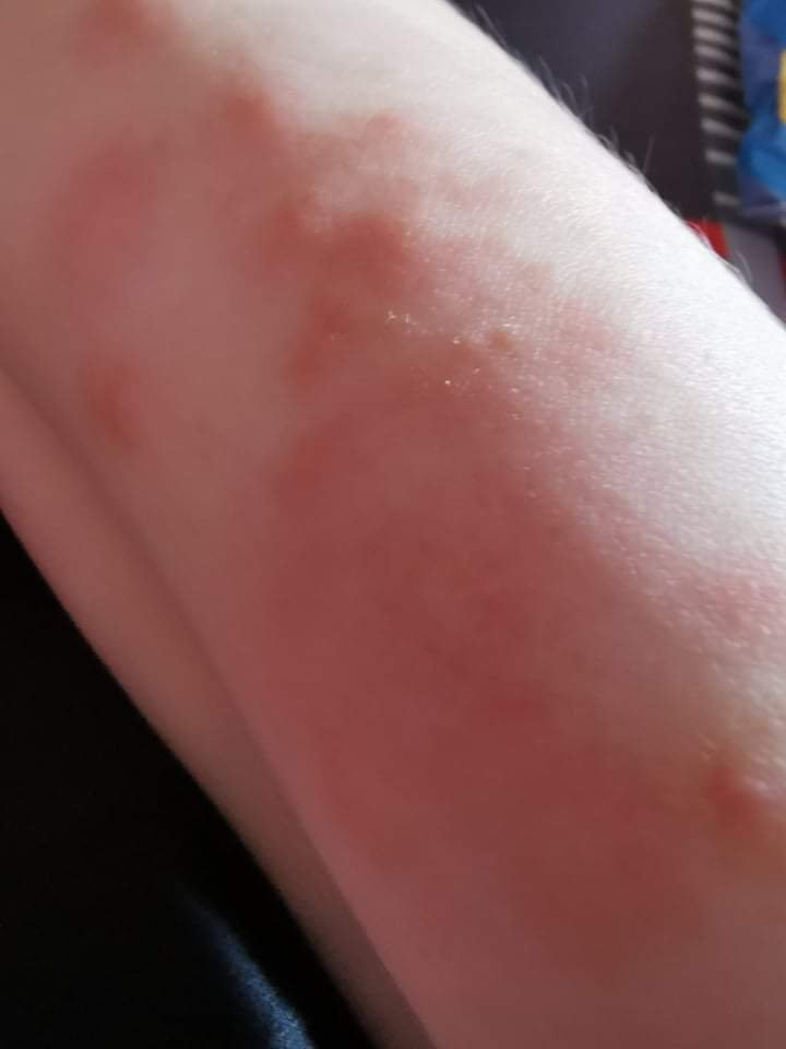 Čo to mám na predlaktí? - Modrý koník