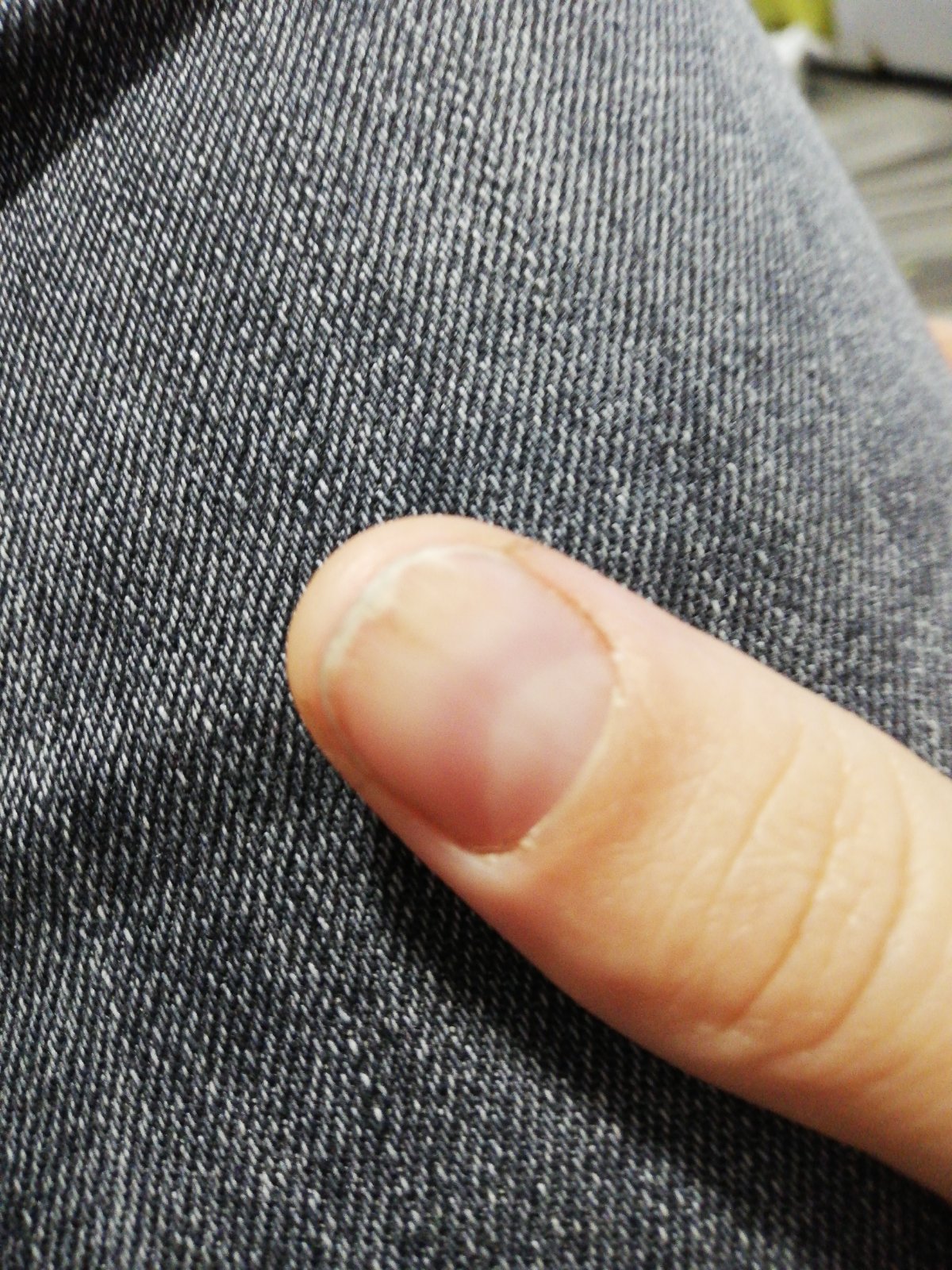 Tmavý pásik na nechte - str. 2 - Modrý koník