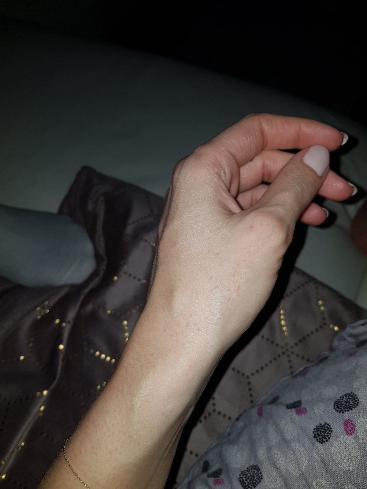 Vyhádzaná ruka a predlaktie (3.trimester). - Modrý koník