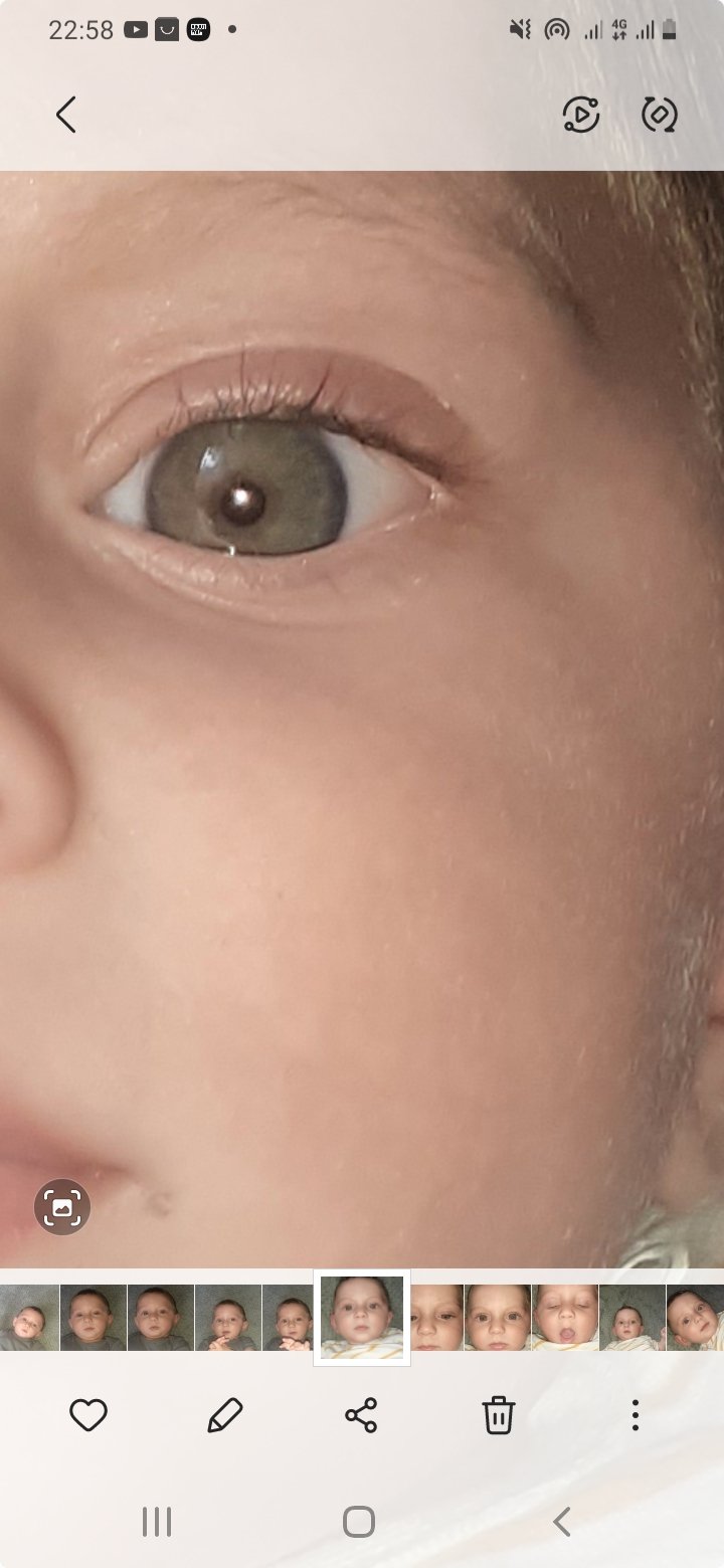 Do akého veku sa mení farba očí? - Modrý koník