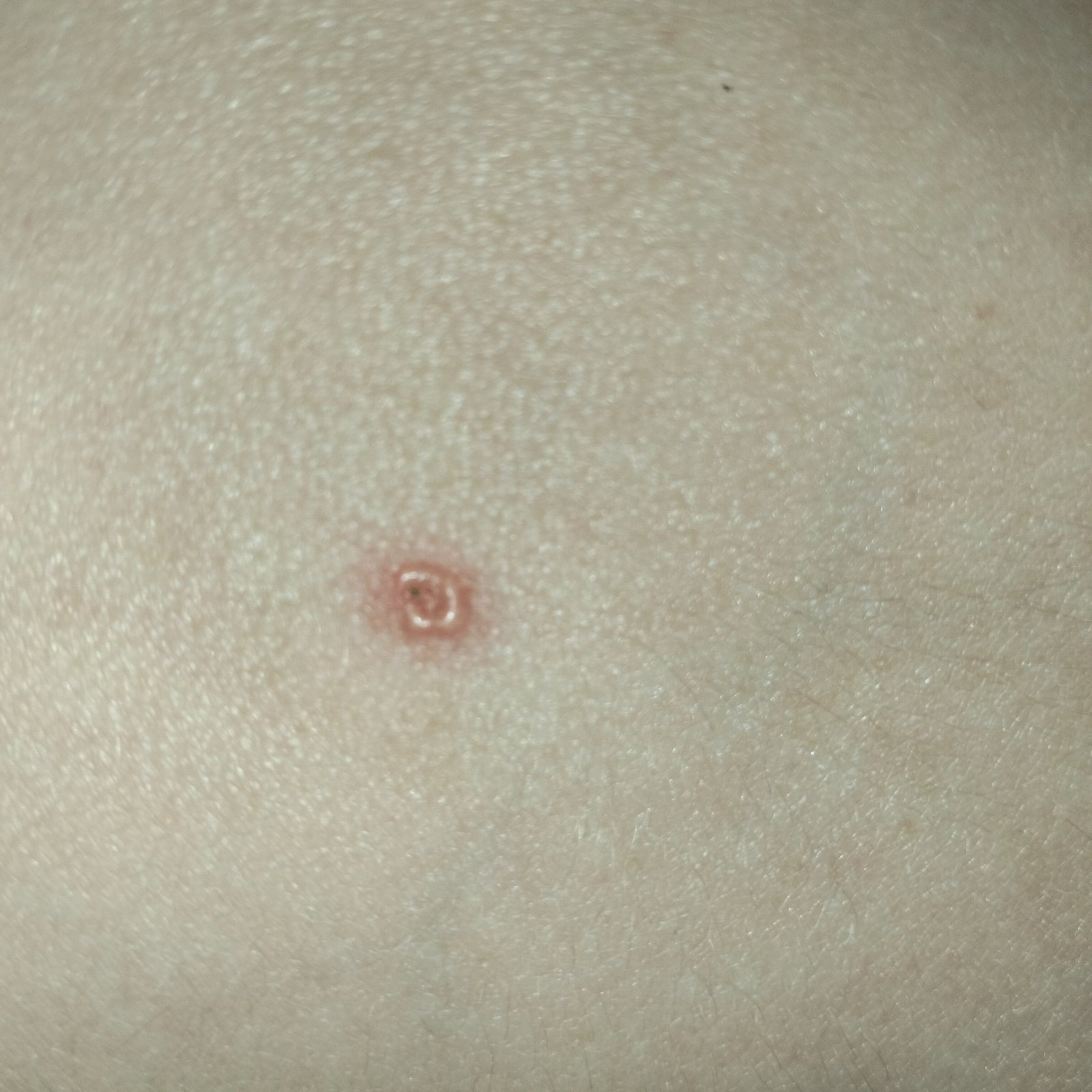 Kiahne? - Modrý koník