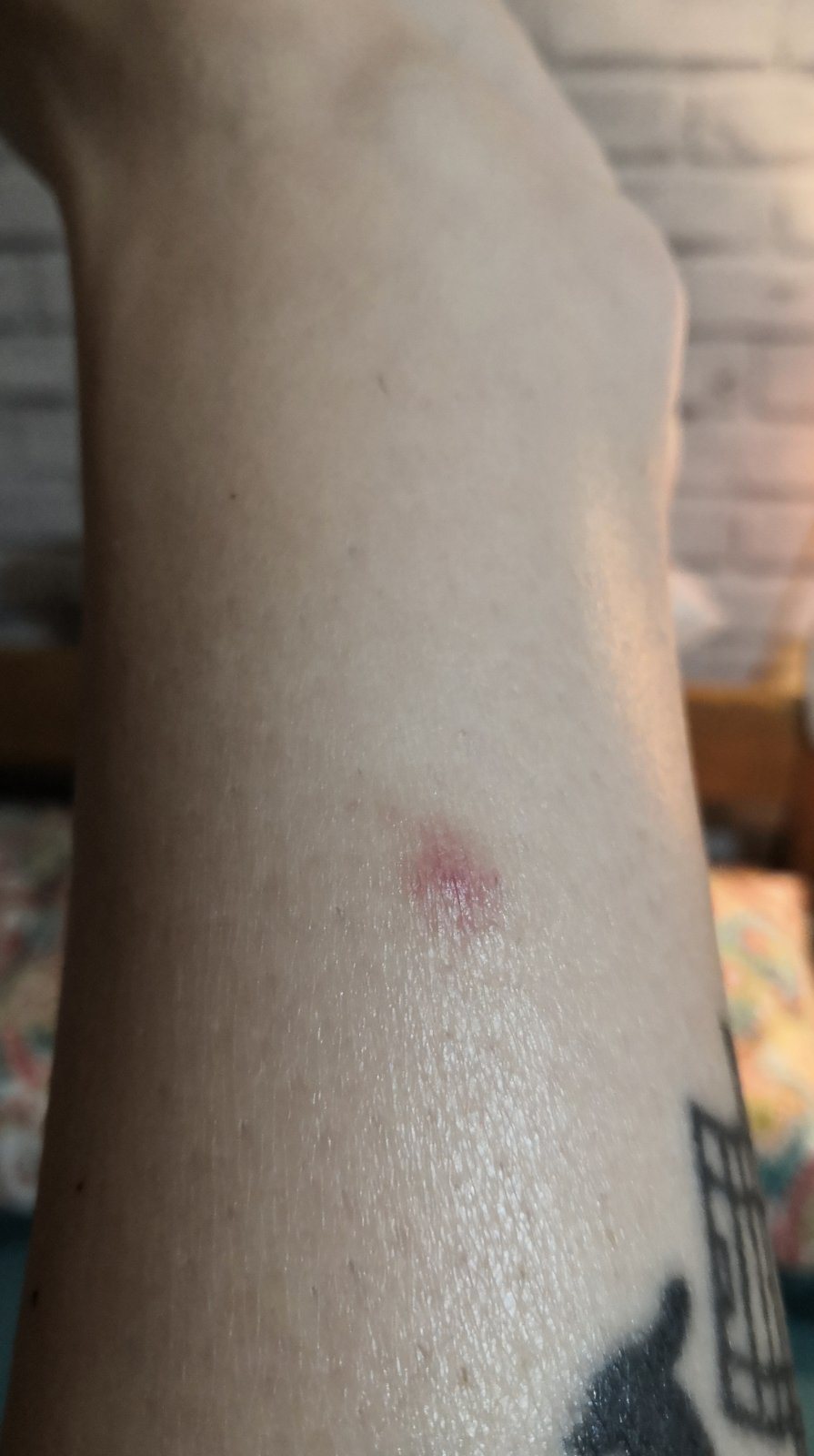 Od čoho sú tieto štípance? - Modrý koník