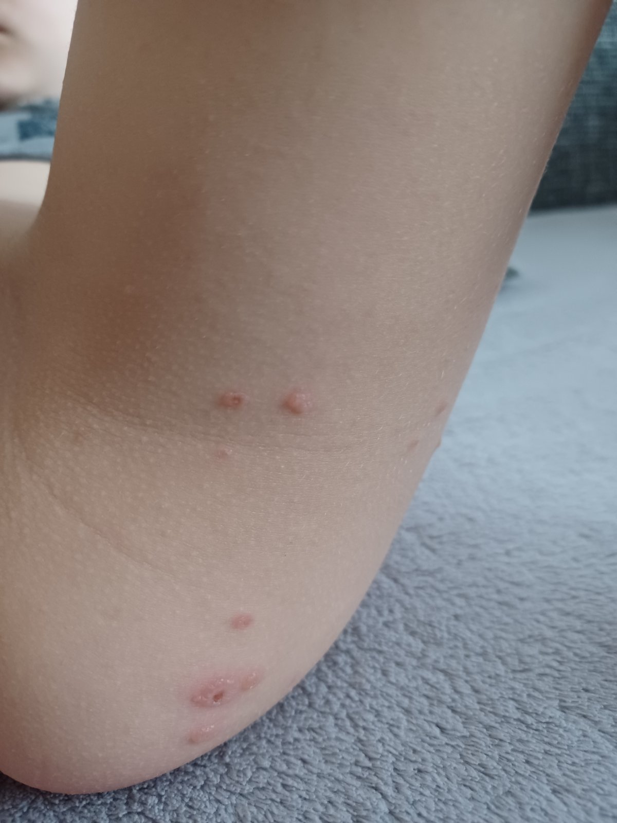 Sú toto ovčie kiahne? - Modrý koník