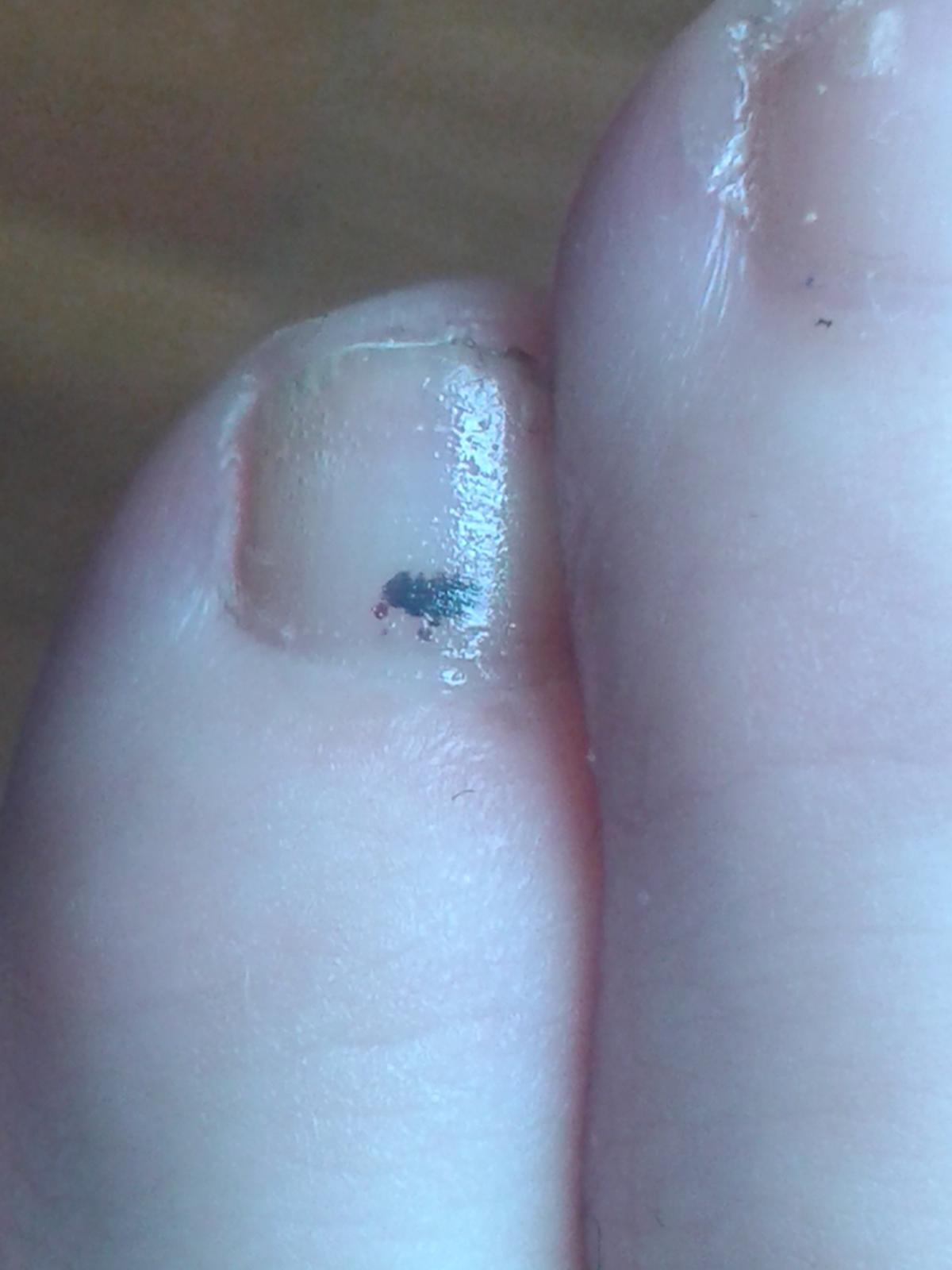 Bodka na nechte - Modrý koník