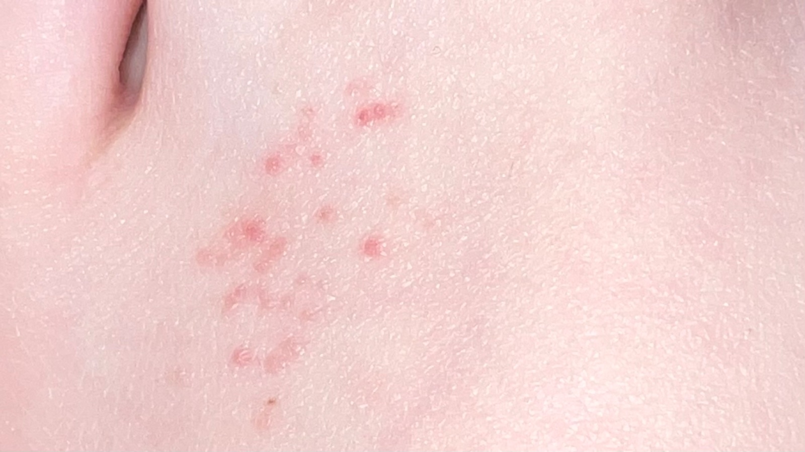 Červené bodky na nohe - Modrý koník