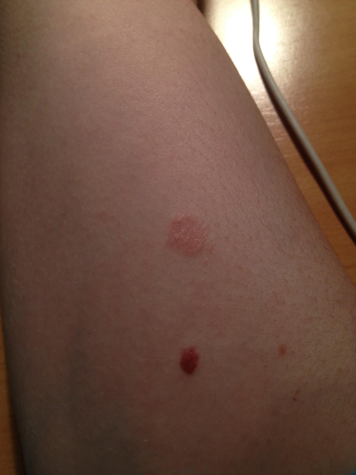 Sú toto ploštice? - Modrý koník