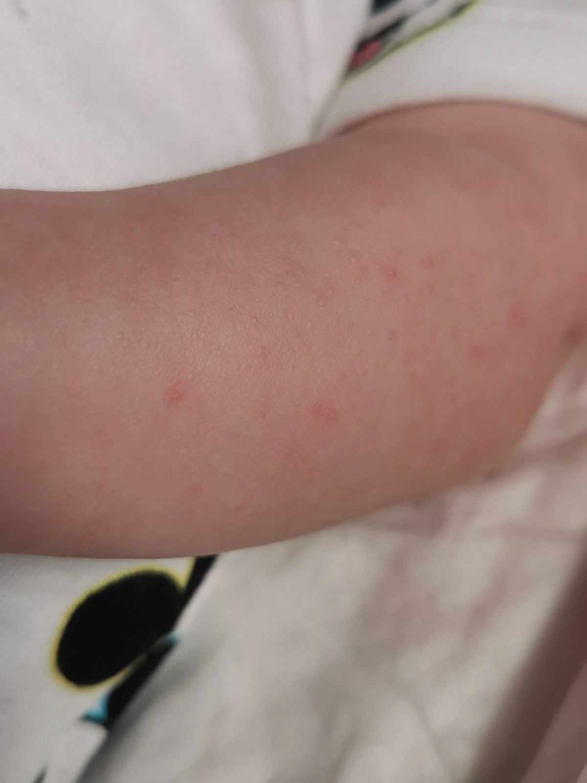 Čo to má syn na ruke? - Modrý koník