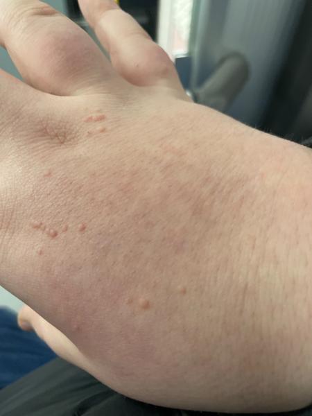 Pupence na rukách - Modrý koník